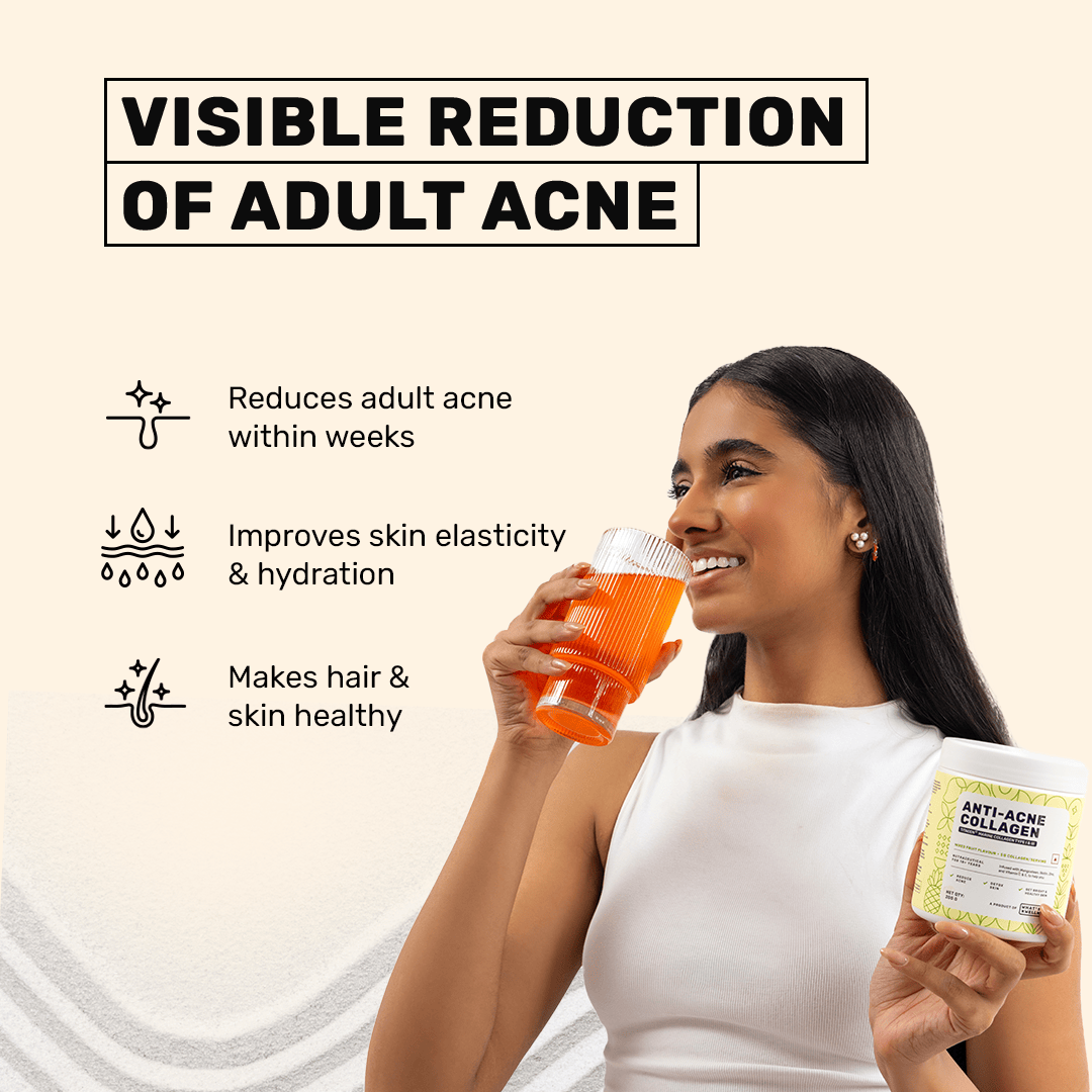 Anti-Acne Collagen - Marine Collagen Powder for Acne & Pimples – What's ...