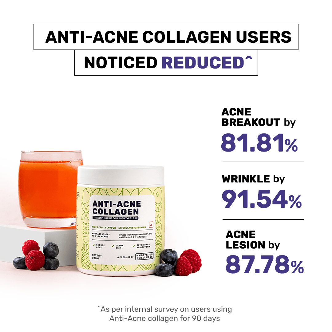 Anti-Acne Collagen - Marine Collagen Powder for Acne & Pimples – What's ...